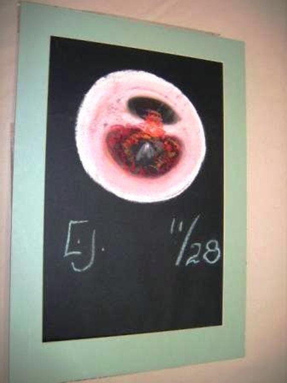 Chevalier Jackson-themed Mütter dress