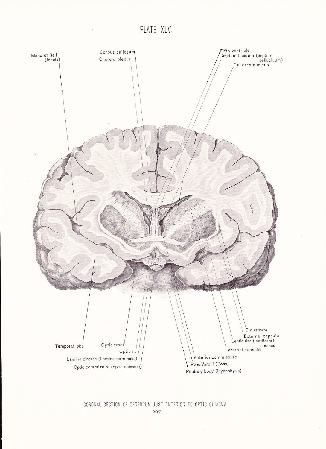 Coronal View Of Brain Blank