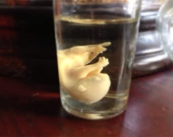 Human Fetal Skeleton in Glass Womb by DeathIsntTheEnd on Etsy