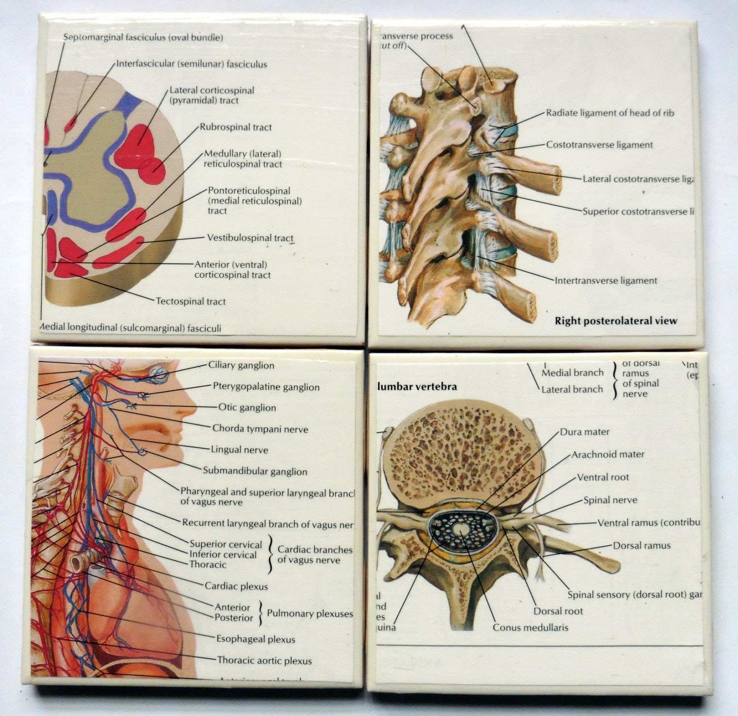 Netter Spinal Anatomy Coasters