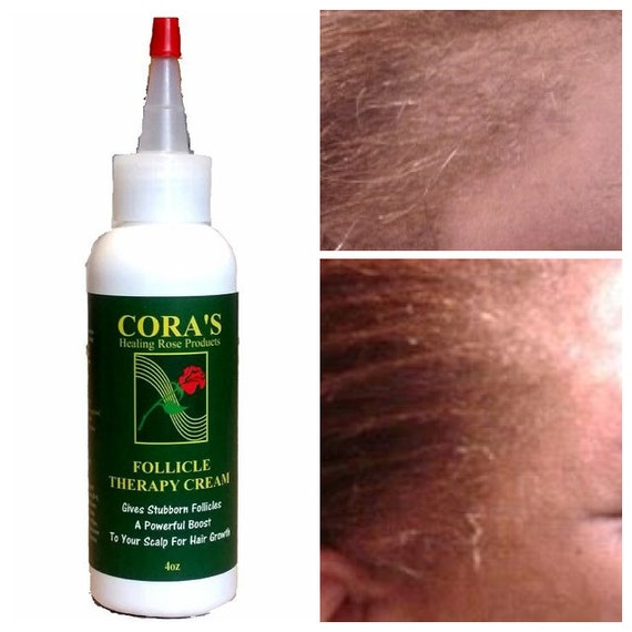 Cream To Kill Hair Follicles at Evelyn Lawson blog