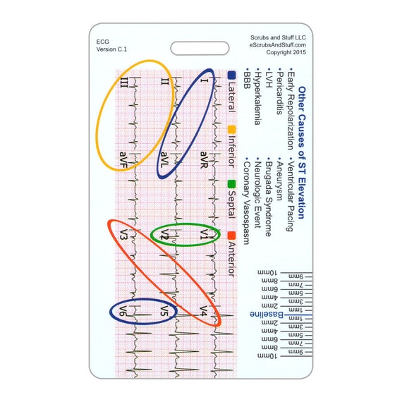 STEMI Reference Tool Vertical Badge Pocket Card for Nurse