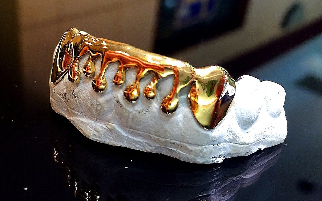 10k solid real yellow gold drip style grill dripping grillz