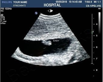 Fake ultrasound | Etsy