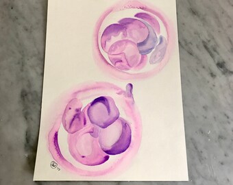 Fertility art print Fructus: Womb fruit baby/ embryo surreal