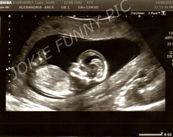 Fake ultrasound | Etsy